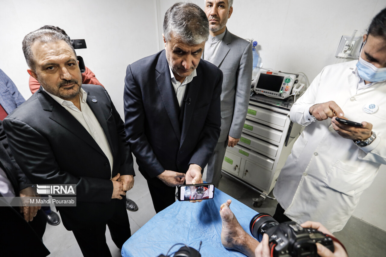 IRNA English - Iran unveils home-made plasma therapy machine